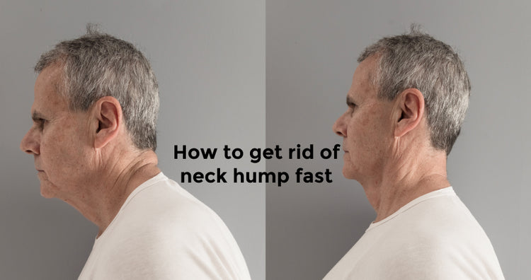 How To Get Rid Of Neck Hump Fast: Effective Strategies & Exercises ...